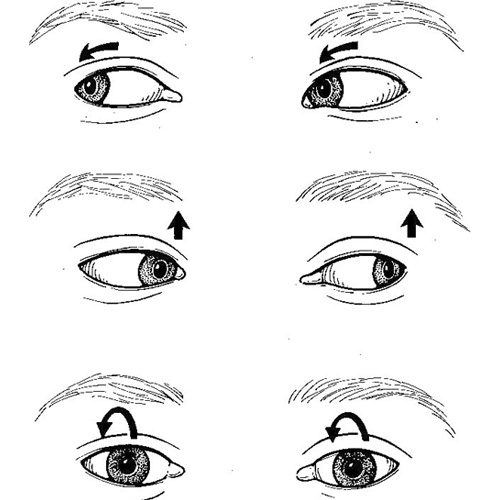 EXERCÍCIOS DE REABILITAÇÃO VESTIBULAR (CAWTHORNE) – Clínica Dr. Carlos ...